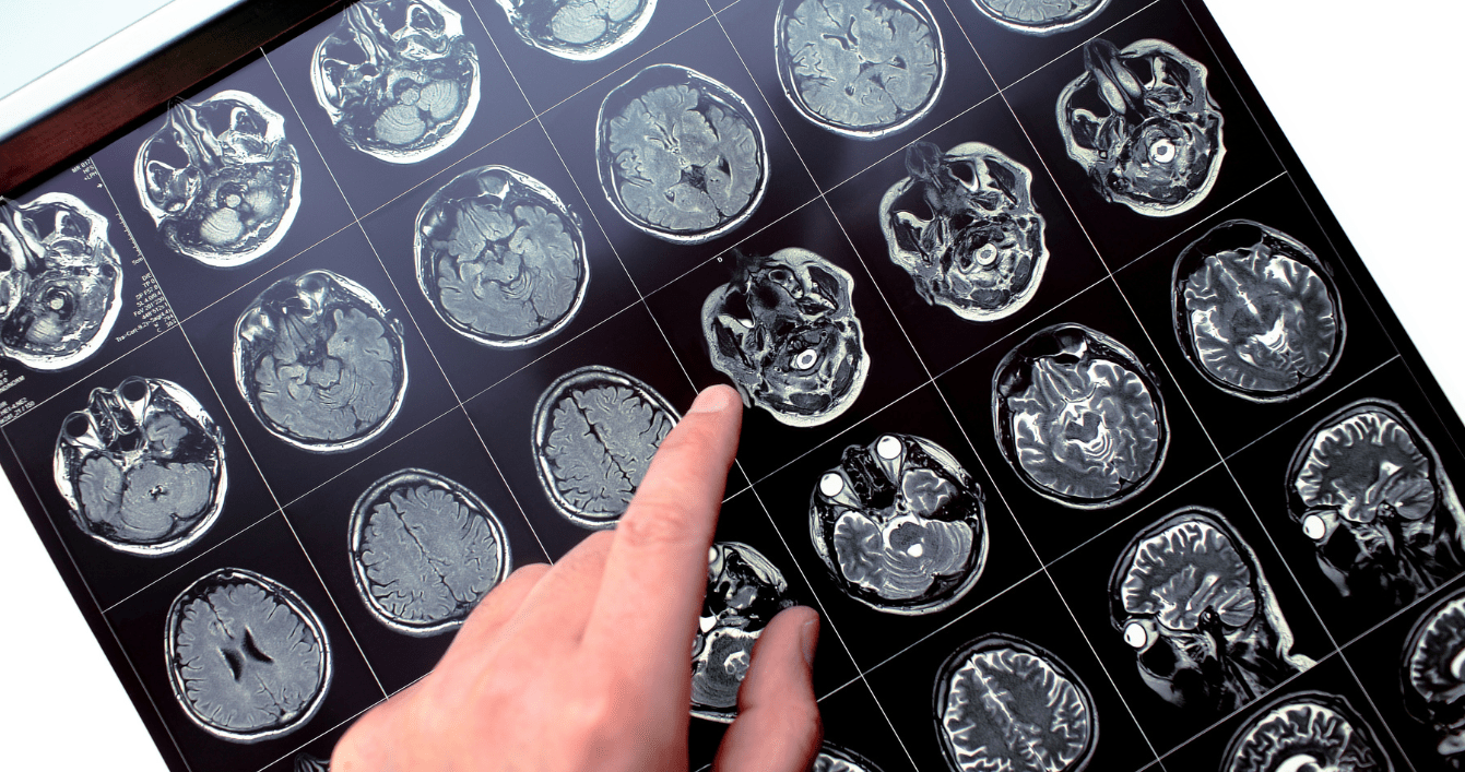 QEEG Test/Brain Mapping Available Call Us Now 954-900-5072